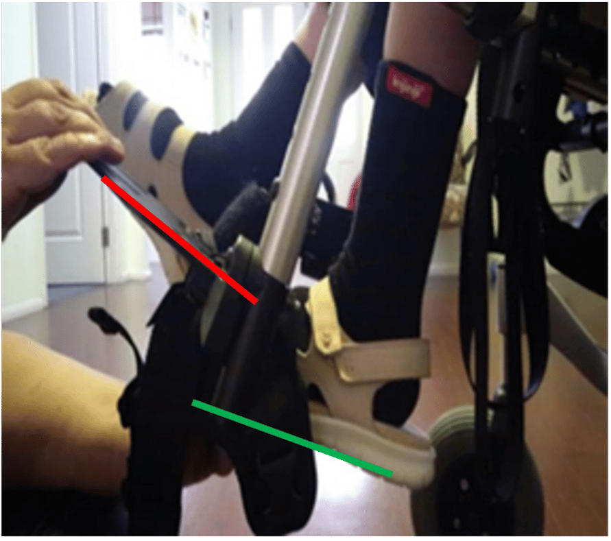 Inferior Foot Supports – Positioning for ROM